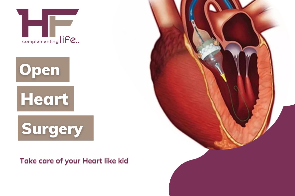 Open Heart Surgery HealthFinder